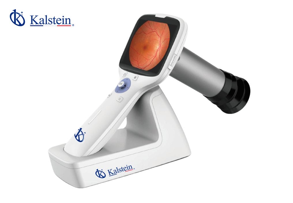 Veterinary Infrared Retinal Camera: Advanced Detection of Ocular ...